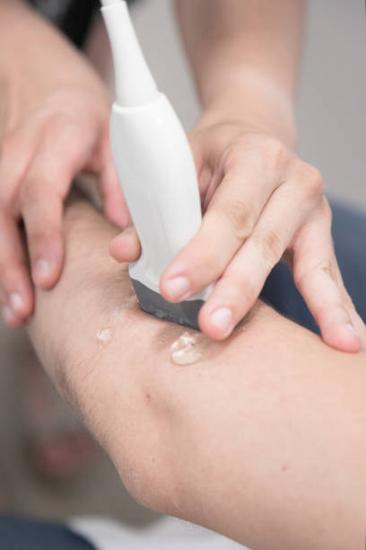 A vertical shot of doppler ultrasound exam of an arm – SCUF